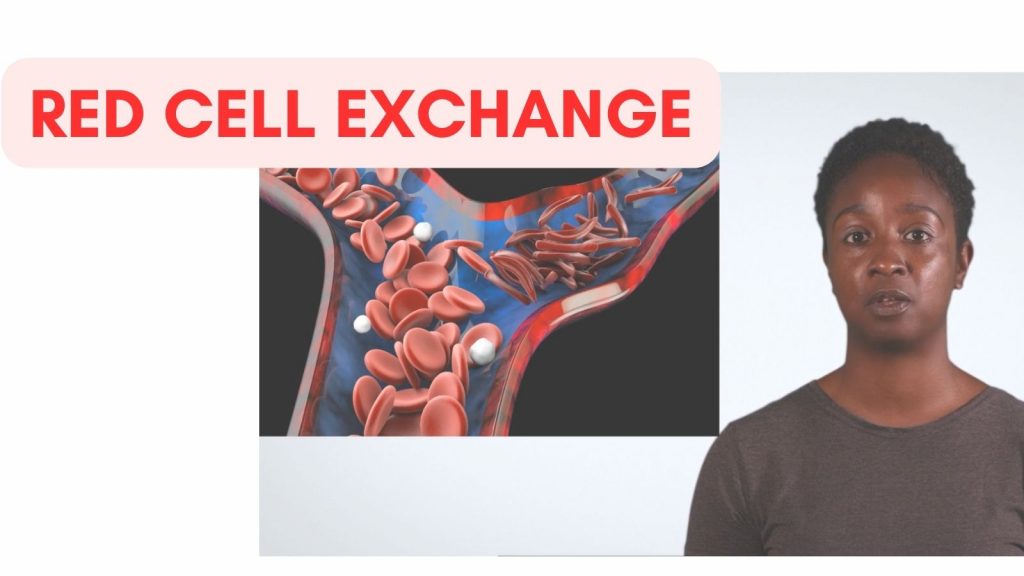 website image RED CELL EXCHANGE » Sickle Cell Society
